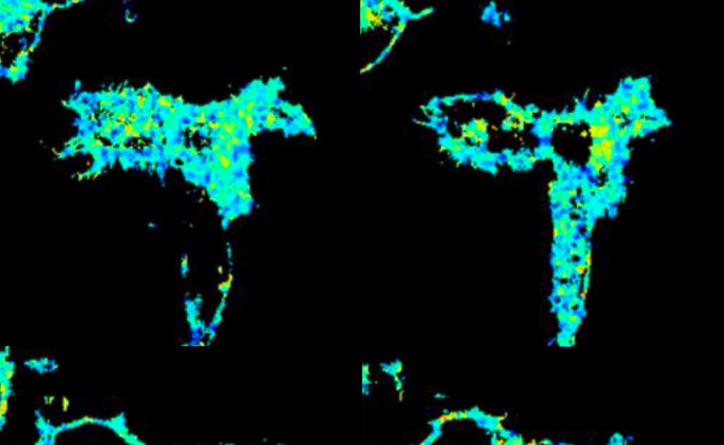Fluorescence Lifetime Imaging » Photon Force